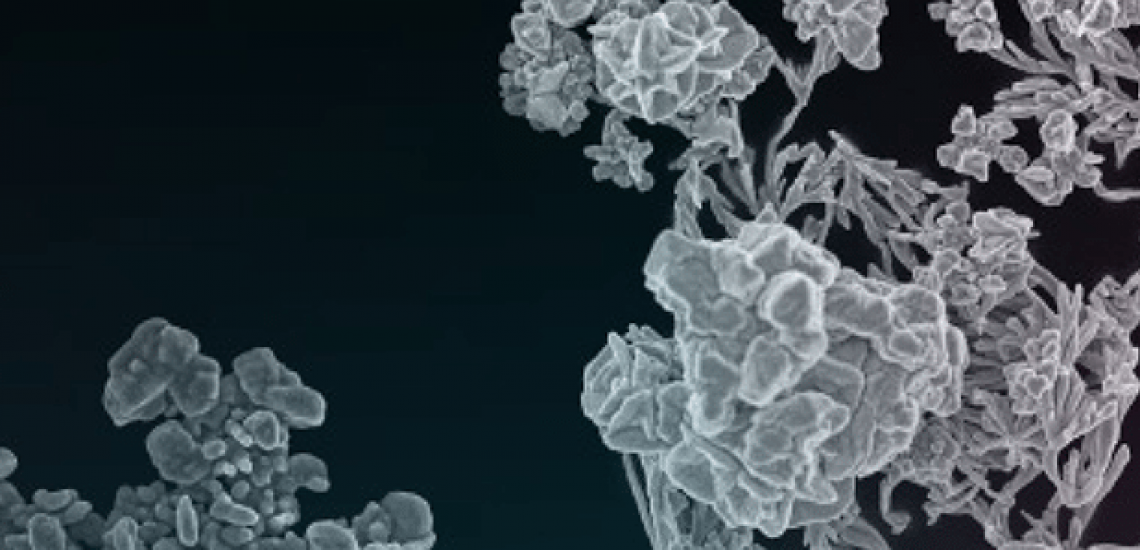 Electron Backscatter Diffraction (EBSD) Microscopy Overview